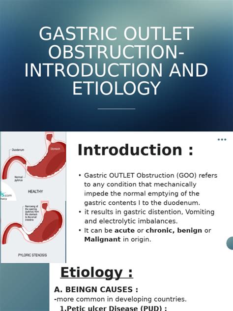 Gastric Outlet Obstruction 20250610 142459 0000 Pdf
