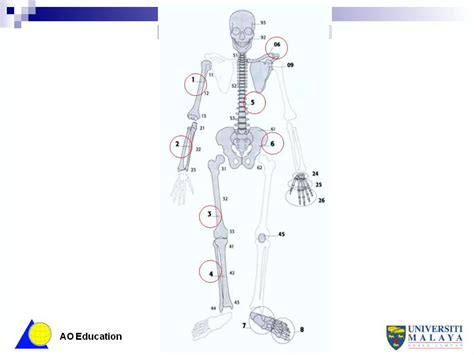 03 Ao Fracture Classification V Nese Ppt