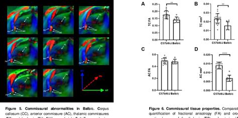 Figure 3 From Direct Interhemispheric Cortical Communication Via Thalamic Commissures A New