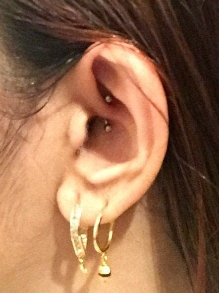 Picture Of Daith That Rejected Today After 1 1 2 Weeks Please Help Me Troubleshoot Piercing