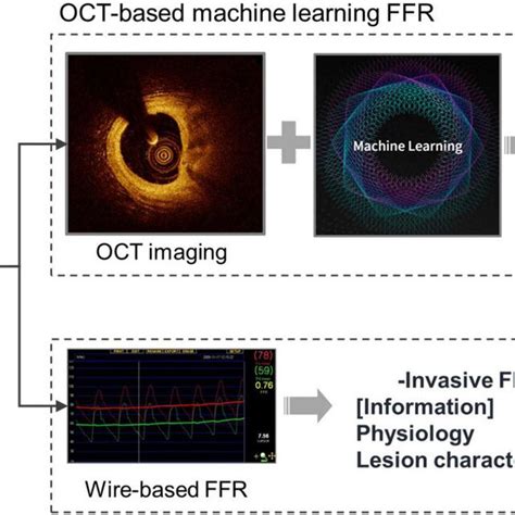 Advantage Of Oct Based Machine Learning Ffr Download Scientific Diagram