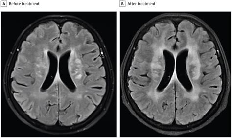 This Is What It Looks Like When Parasitic Worms Directly Invade Your