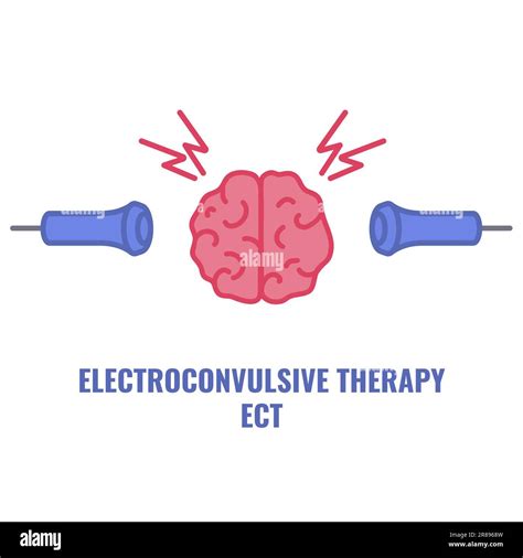 Ect Brain