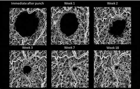 Proliferation And Neovascularization Download Scientific Diagram
