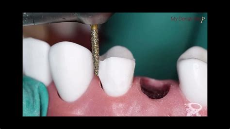 Cdca Exam Prep 3 To 5 Youtube