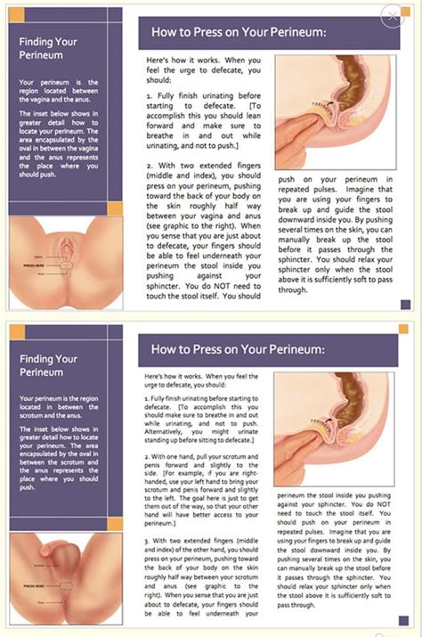 Fleet Liquid Suppository Vs Traditional Suppository R Constipation