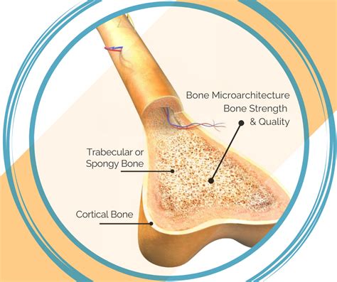 What Is Rems Rems Sw Echolight Rems Bone Scans