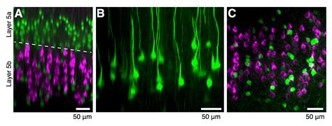 Large Scale Three Dimensional Imaging Of Cellular Organization In The Mouse Neocortex