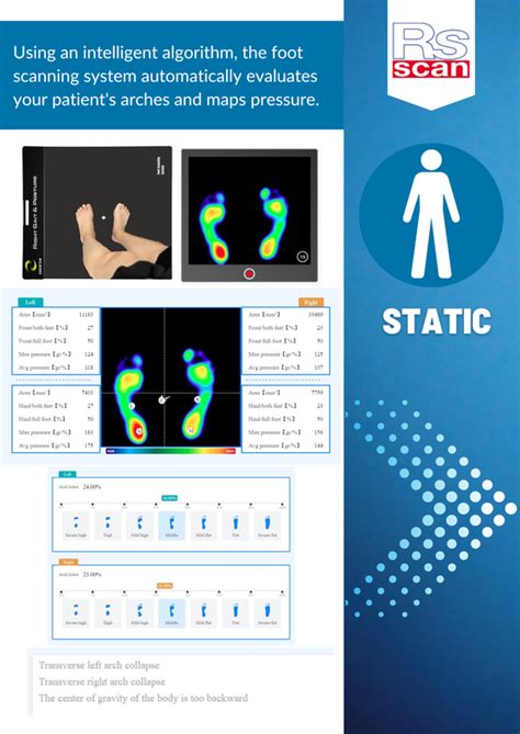 Static Measurement Rsscan Lab