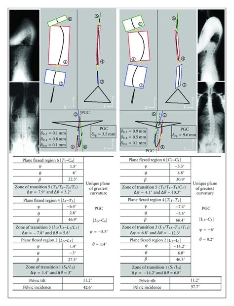 Cases Of Two Asymptomatic Adults 40 And 30 Years The Comparison