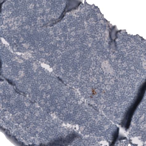 Invitrogen Claudin 3 Monoclonal Antibody Cl13128 100 μl Unconjugated