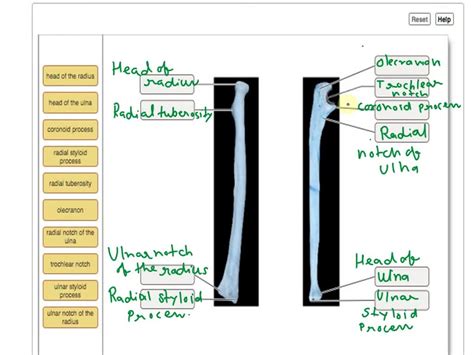 Solved Drag The Labels Onto The Diagram To Identify The Markings Of The Forearm Elbow Head Of