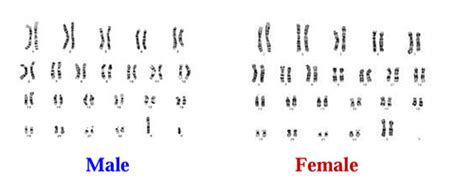 Sex Chromosomes And Chromosomal Rearrangements Genetics Flashcards Quizlet