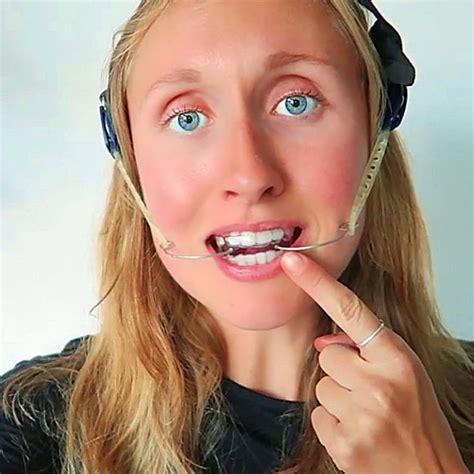 Pin By Bruce Nicolosi On Headgear Dental Braces Orthodontics Braces