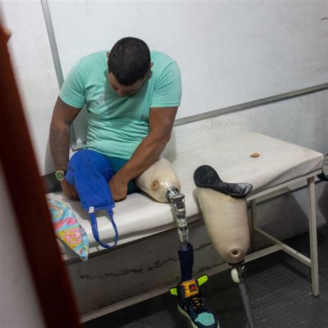 A Unique Model Can Help Prevent Leg Amputation Stat