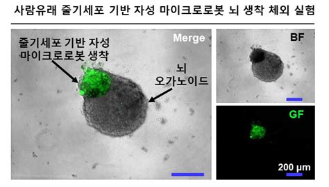 dgist 코를 통해 뇌 신경계 질환치료가 가능한 마이크로로봇 개발 전자신문