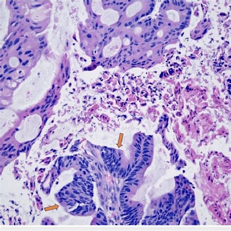 Axial T2 Turbo Spin Echo Tse Magnetic Resonance Imaging Mri Brain Download Scientific