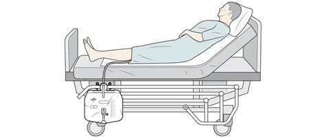 Optimizing Catheter Care By CNAs And Other Non Clinicians