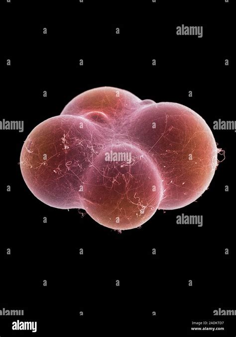 Fat Cells Coloured Scanning Electron Micrograph Sem Of Four Joined Fat Storing Cells