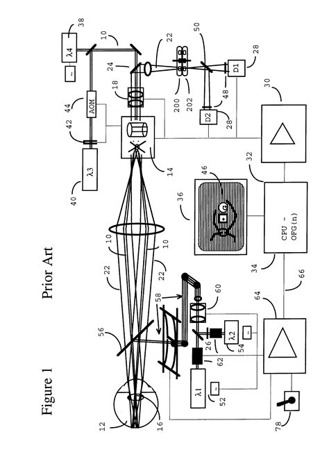 Scanning Laser Ophthalmoscope Patented Technology Retrieval Search Results Eureka Patsnap