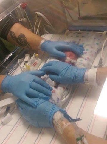 Two Different NICU Experiences Prolacta Bioscience