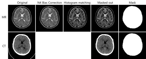 Github Chengbinjin Mri To Ct Dcnn Tensorflow This Repository Is The