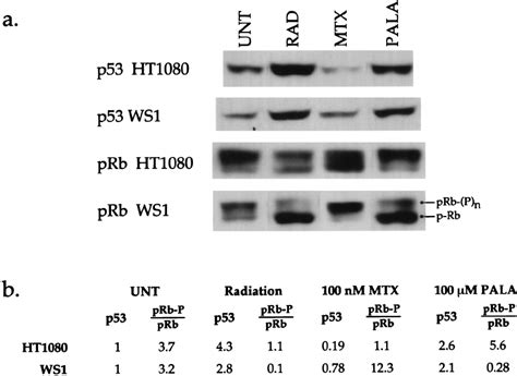 Effects Of Radiation Pala And Mtx On P53 And Prb Expression In Ht1080
