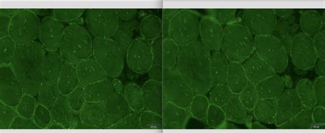 Why Are My Negative Control Slides Staining Positive With IF ResearchGate