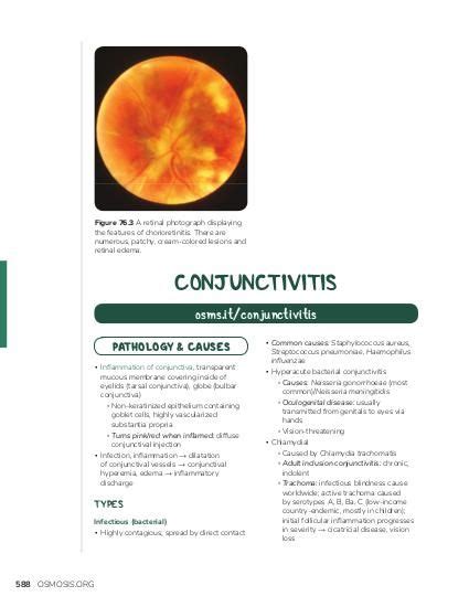 Conjunctivitis Osmosis