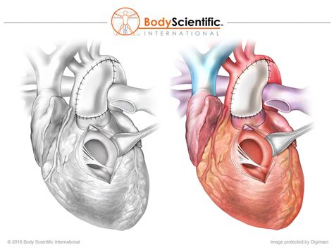 Colorization Technique Artists Blogs Medical Illustration Sourcebook
