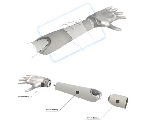 Prosthetic Socket Redesign On Behance Prosthetic Socket Redesign On Behance