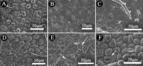 Leaf Lower Epidermis Of Lauraceae Under Scanning Electron Microscope