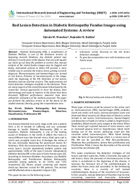 Pdf Irjet Red Lesion Detection In Diabetic Retinopathy Fundus Images Using Automated Systems
