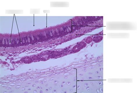Trachea Histology 2 Diagram Quizlet