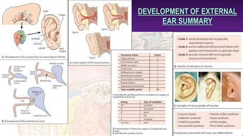 Anatomy And Development Of External Ear Pptx