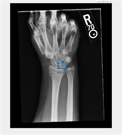 Medicalsegmentanythingmodel Pretrained Medical Segment Anything Model Medsam For Medical