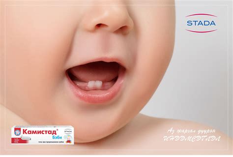 №3 👶Хүүхдийн цахиур шүд цухуйж Stada Cis Mongolia