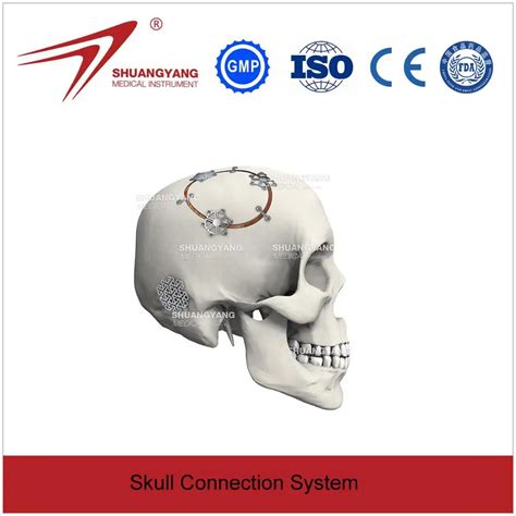 Titanium Mesh For Cranial Skull Connection System Buy Titanium Mesh