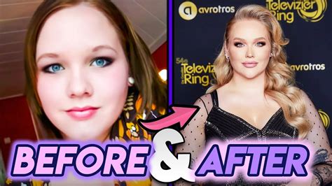 Nikkietutorials Before And After Transformations Her Cosmetic Surgery And More