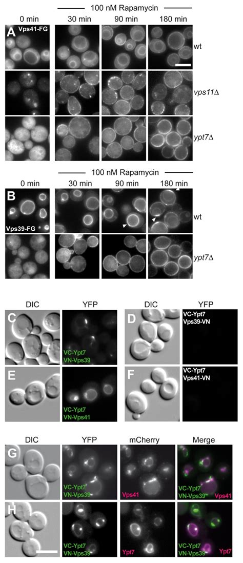 Vps41 And Vps39 Differ In Vacuole Affinity And Co Localization With Download Scientific Diagram