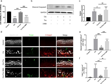 Inhibiting Autophagy Reverses The Effect Of Trehalose On Download