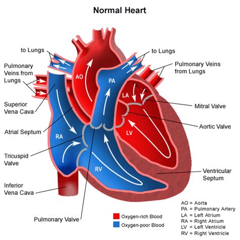 Truncus Arteriosus