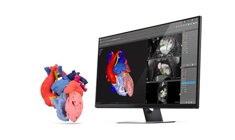 D2p Dicom 3d Modeling Software At Best Price In Mumbai Id 26630595662