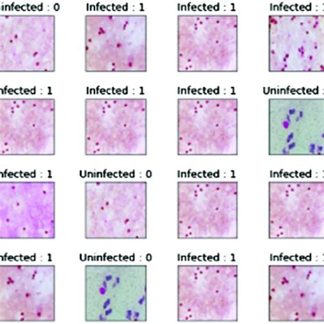 Block Diagram Of Malaria Detection Using Resnet Download Scientific Diagram
