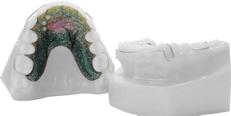 Retainers Ricoh Orthodontic Appliances