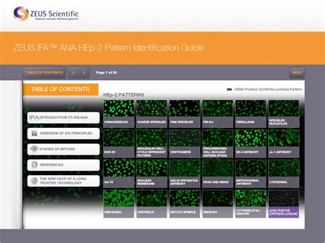 Zeus Ifa Digital Ana Hep 2 Cell Pattern Identification Guide Hd By Zeus Scientific Inc