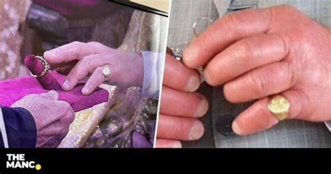 Doctor Explains Why King Charles Iii Has Sausage Fingers Flipboard