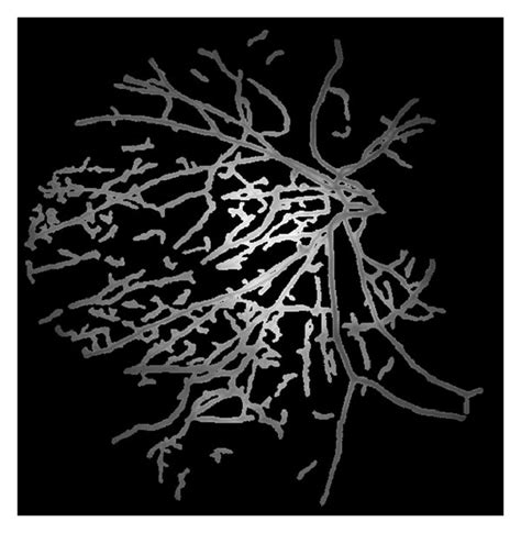 Two Segmentation Results Of Ill Conditioned Retinal Images The Download Scientific Diagram