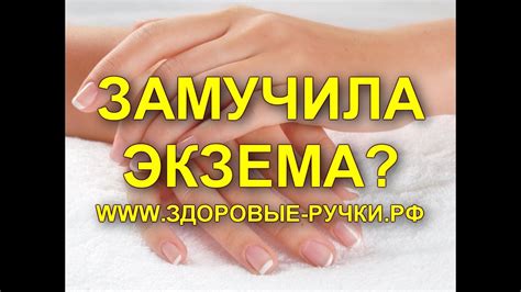 Экзема на руках причины воспаления симптомы и эффективные способы лечения