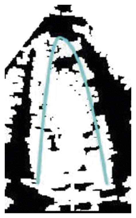 Binary Image Processing A Three Phase Level Set Segmentation